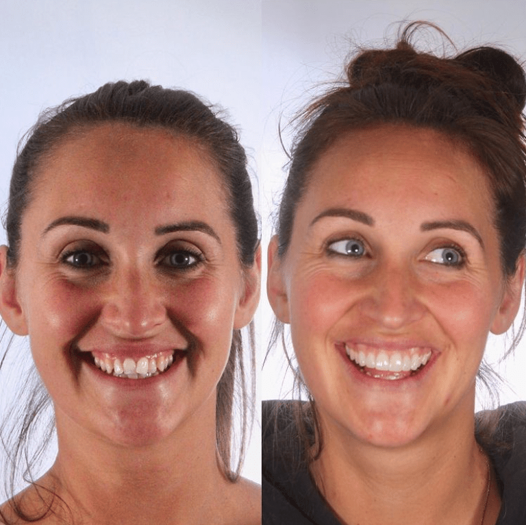 Smile Gallery - Dentist In Shepperton, Surrey