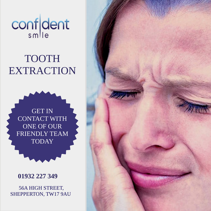 Tooth Extraction Shepperton Surrey - Confident Smile Clinic